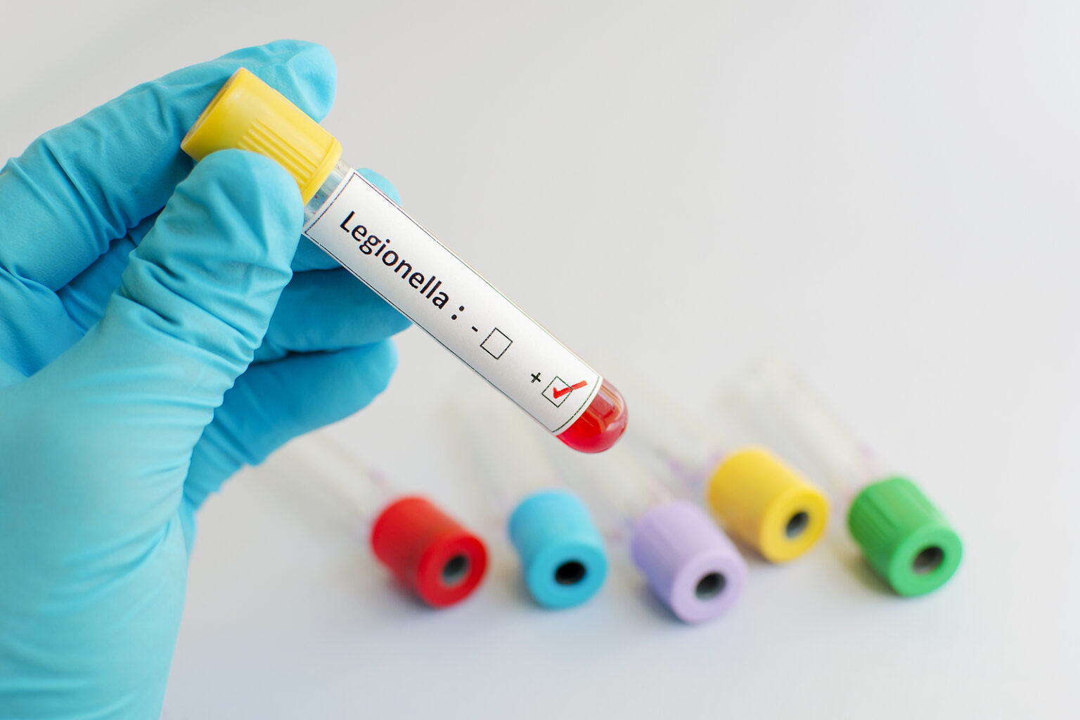 What Is Legionnaires’ Disease? Symptoms, Treatment & Prevention